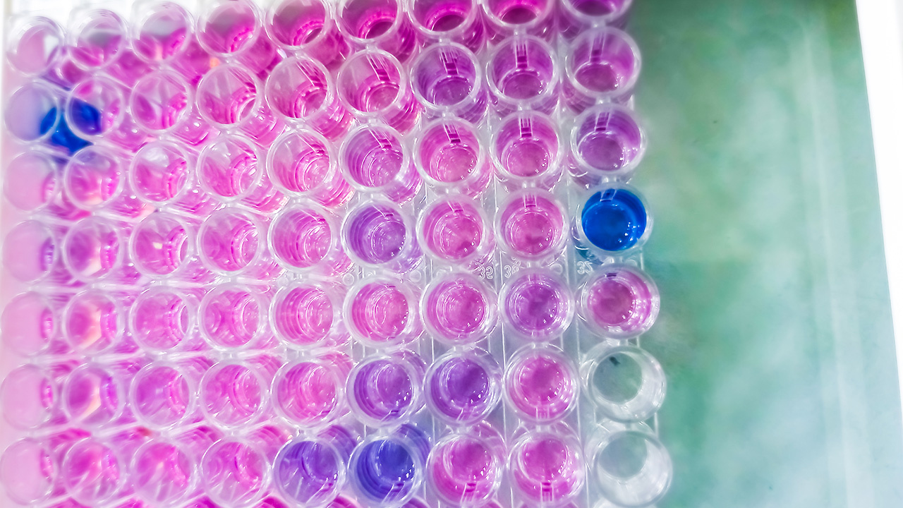 Disease Detectives with ELISAs | NCBioNetwork.org