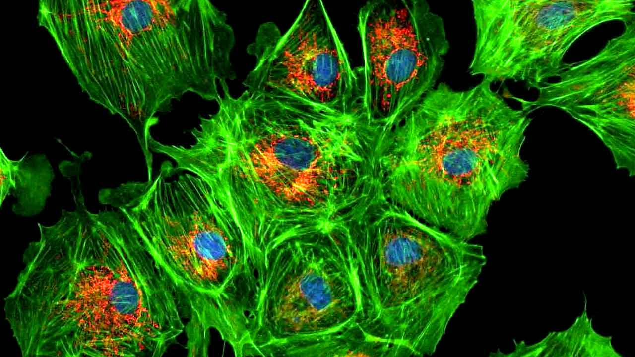 Green Fluorescent Protein (GFP) | NCBioNetwork.org
